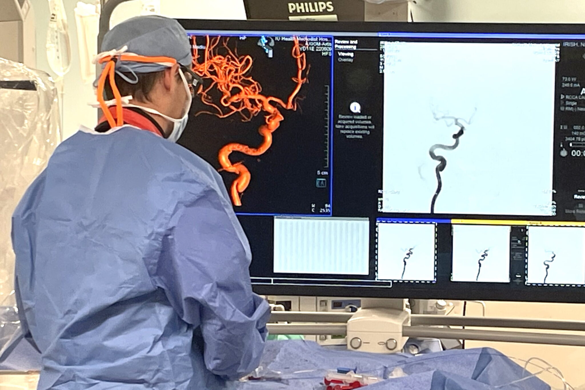 Best Neuro Vascular Surgery Hospital in Hyderabad